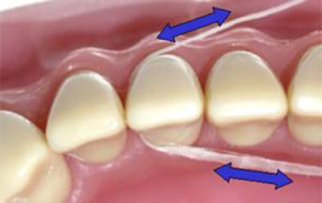 How to Floss Your Teeth: Easy Step by Step Guide [and Video]